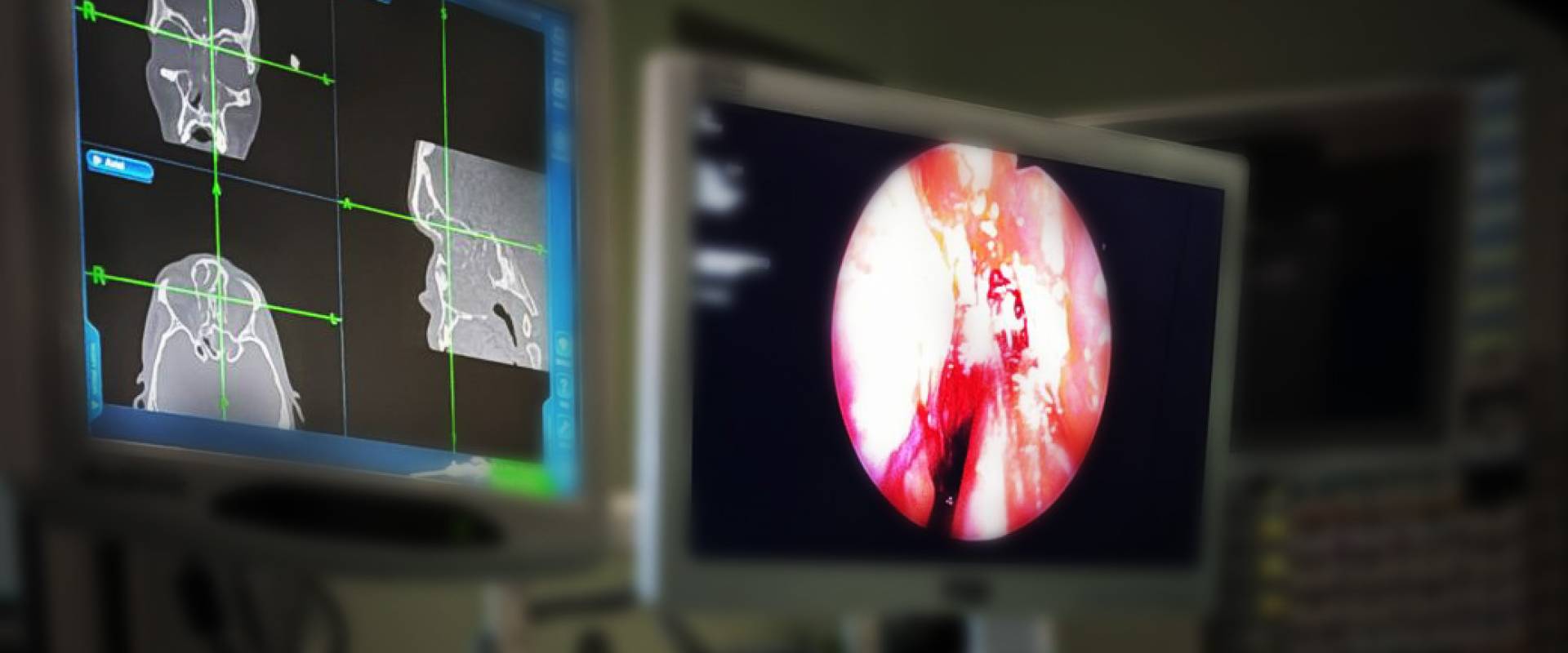 Ct Sinus